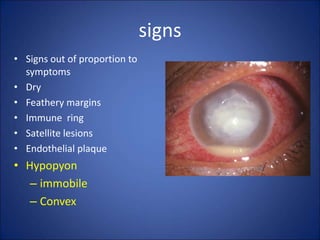 RAMJI PANDEY cornea class-2 | PPT