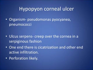 RAMJI PANDEY cornea class-2 | PPT