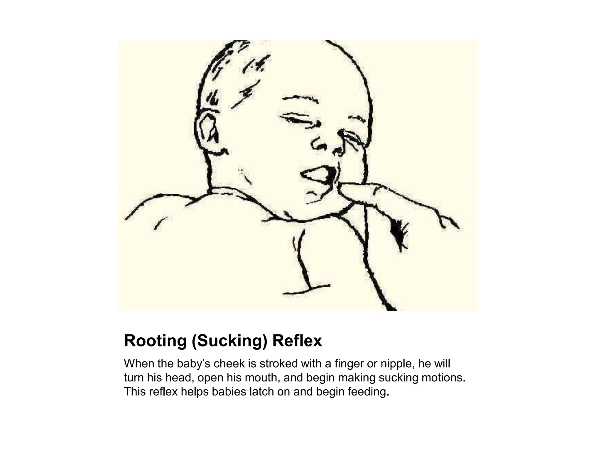 fdocuments.in_newborn-reflexes-56cbe301a45f5.pptx