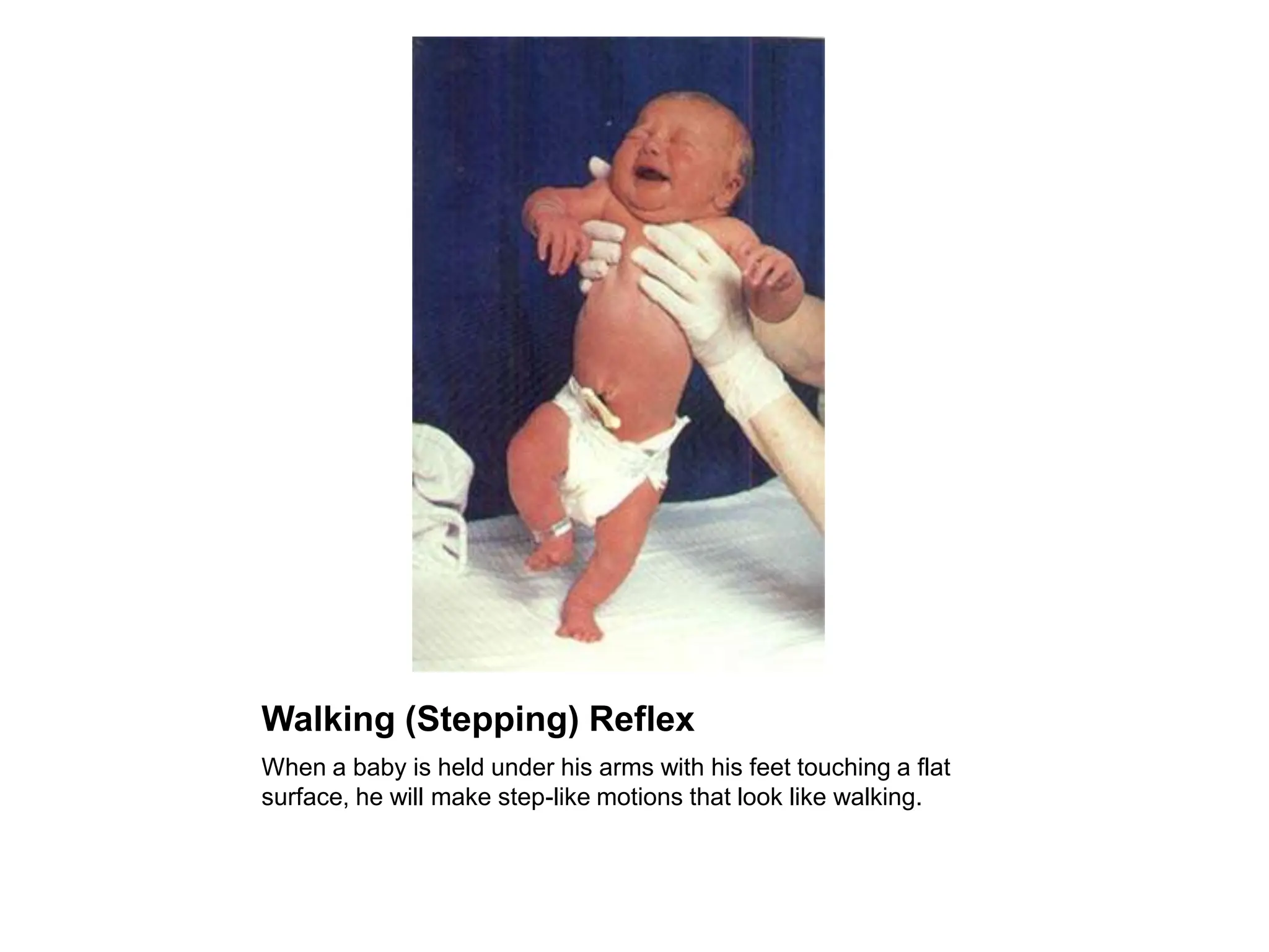 fdocuments.in_newborn-reflexes-56cbe301a45f5.pptx