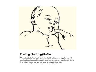 fdocuments.in_newborn-reflexes-56cbe301a45f5.pptx