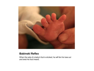 fdocuments.in_newborn-reflexes-56cbe301a45f5.pptx