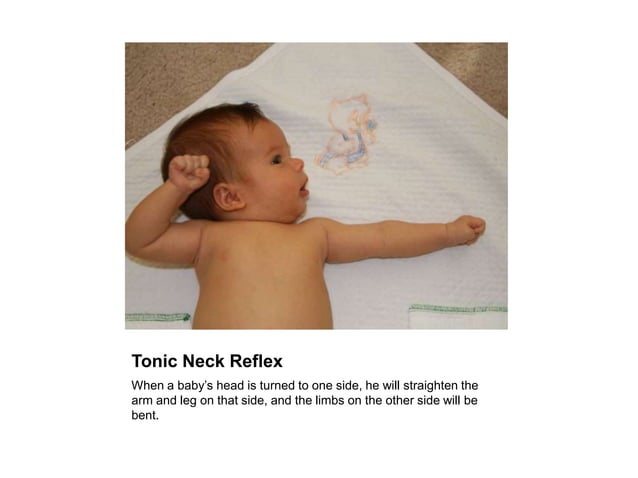 fdocuments.in_newborn-reflexes-56cbe301a45f5.pptx