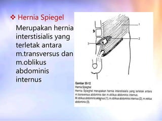 fdokumen.com_hernia-570cbaec68745.ppt