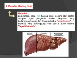 fdokumen.com_gangguan-pada-sistem-pencernaan-manusia.pptx