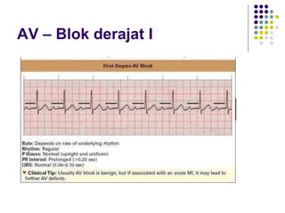 fdokumen.com_case-1-av-block.ppt