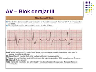 fdokumen.com_case-1-av-block.ppt
