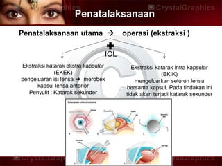 materi-penyuluhan-katarak.pptx