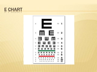 pemeriksaan mata lengkap dalam menentukan kelainan refraksi | PPTX