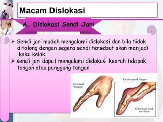 Dislokasi keperawatanhhhhggfffttttfffrrrr | PPTX