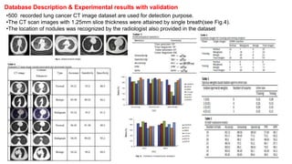 Optimal deep learning model For Classification of Lung Cancer on CT ...