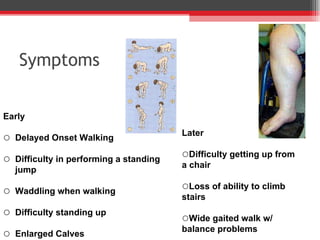 Duchenne Muscular Dystrophy | PPT
