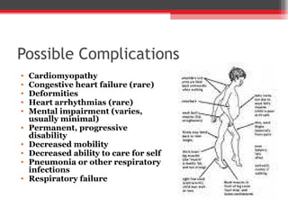 Duchenne Muscular Dystrophy | PPT