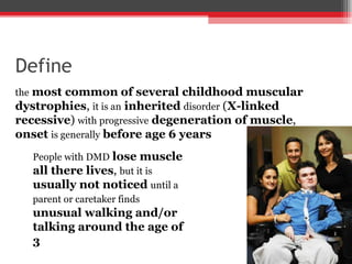 Duchenne Muscular Dystrophy | PPT