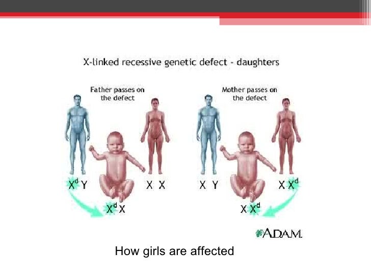 Duchenne Muscular Dystrophy Punnett Square