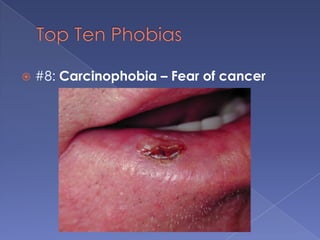 Fears and Phobias for Students | PPTX