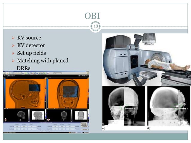 Features of new installed linac Trilogy At Dr Ziauddin Hospital Karachi ...