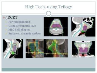Features of new installed linac Trilogy At Dr Ziauddin Hospital Karachi ...
