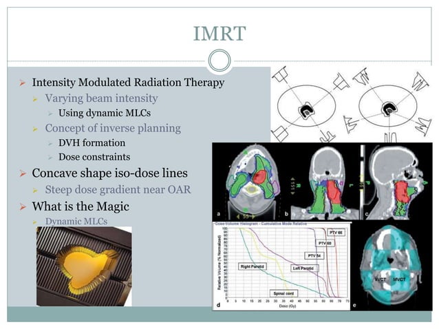 Features of new installed linac Trilogy At Dr Ziauddin Hospital Karachi ...