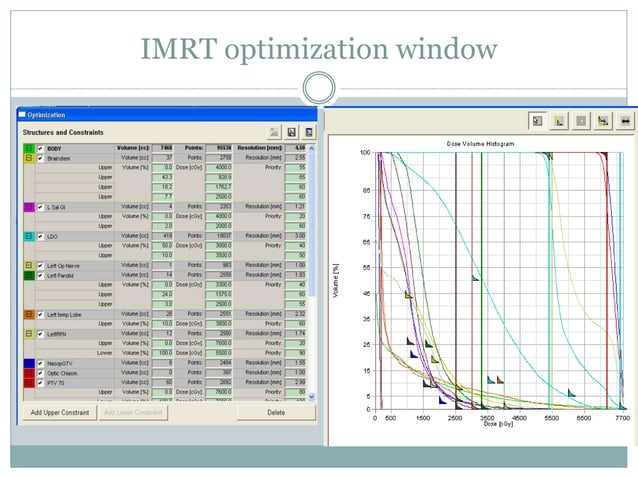 Features of new installed linac Trilogy At Dr Ziauddin Hospital Karachi ...