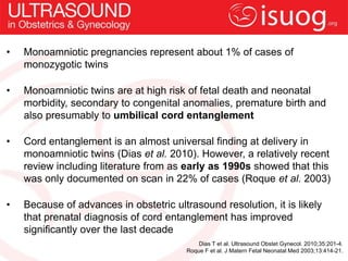 UOG Journal Club: Impact of cord entanglement on perinatal outcome of ...