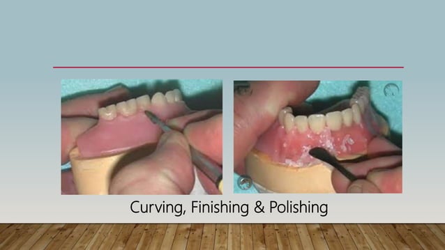Fabrication of Complete Denture.pptx | Dental Health | Diseases and ...