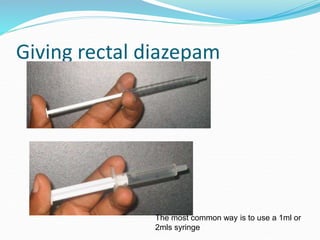 FEBRILE CONVULSIONS.ppt