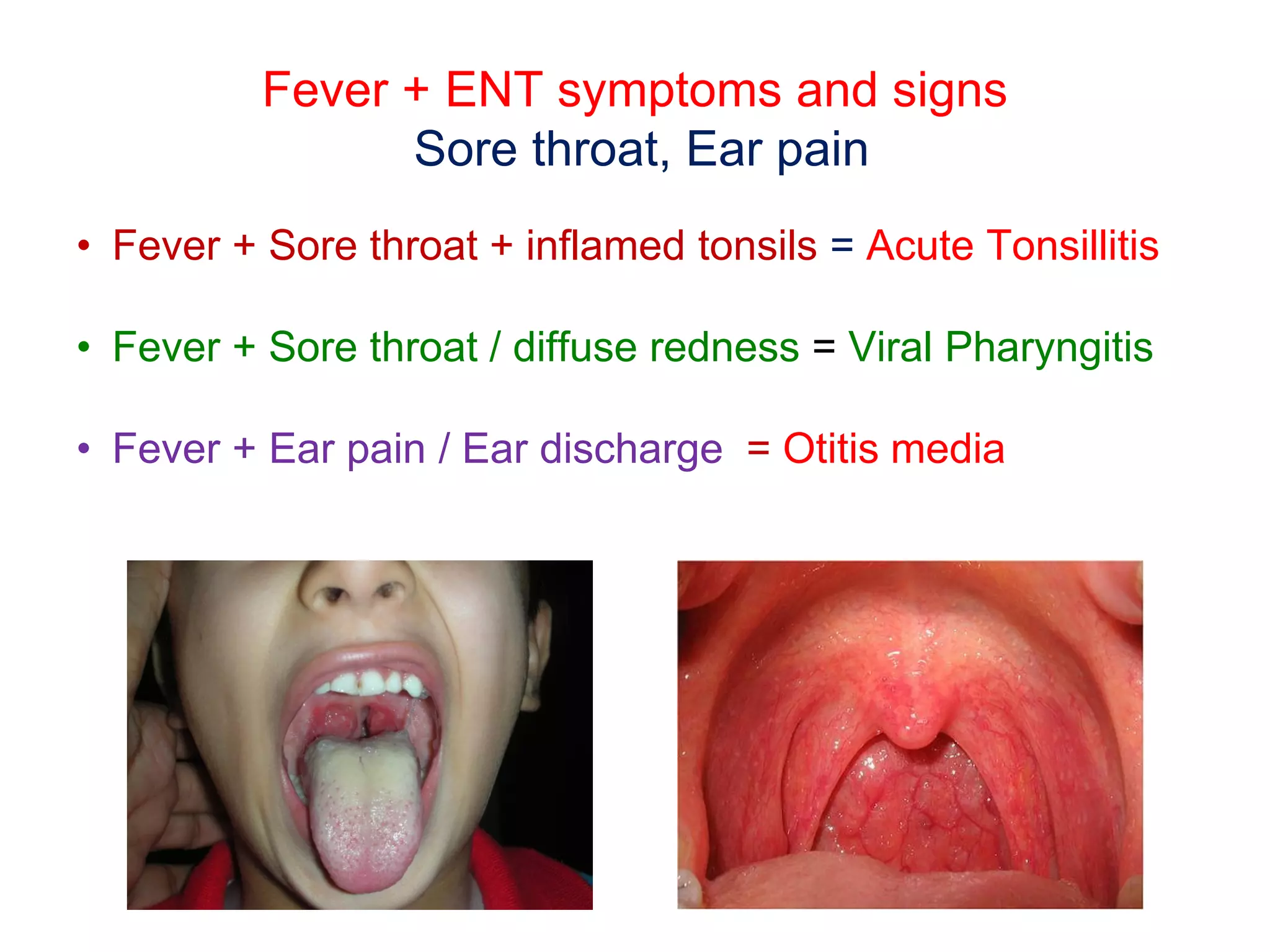 Febrile illness in children 2021 | PDF