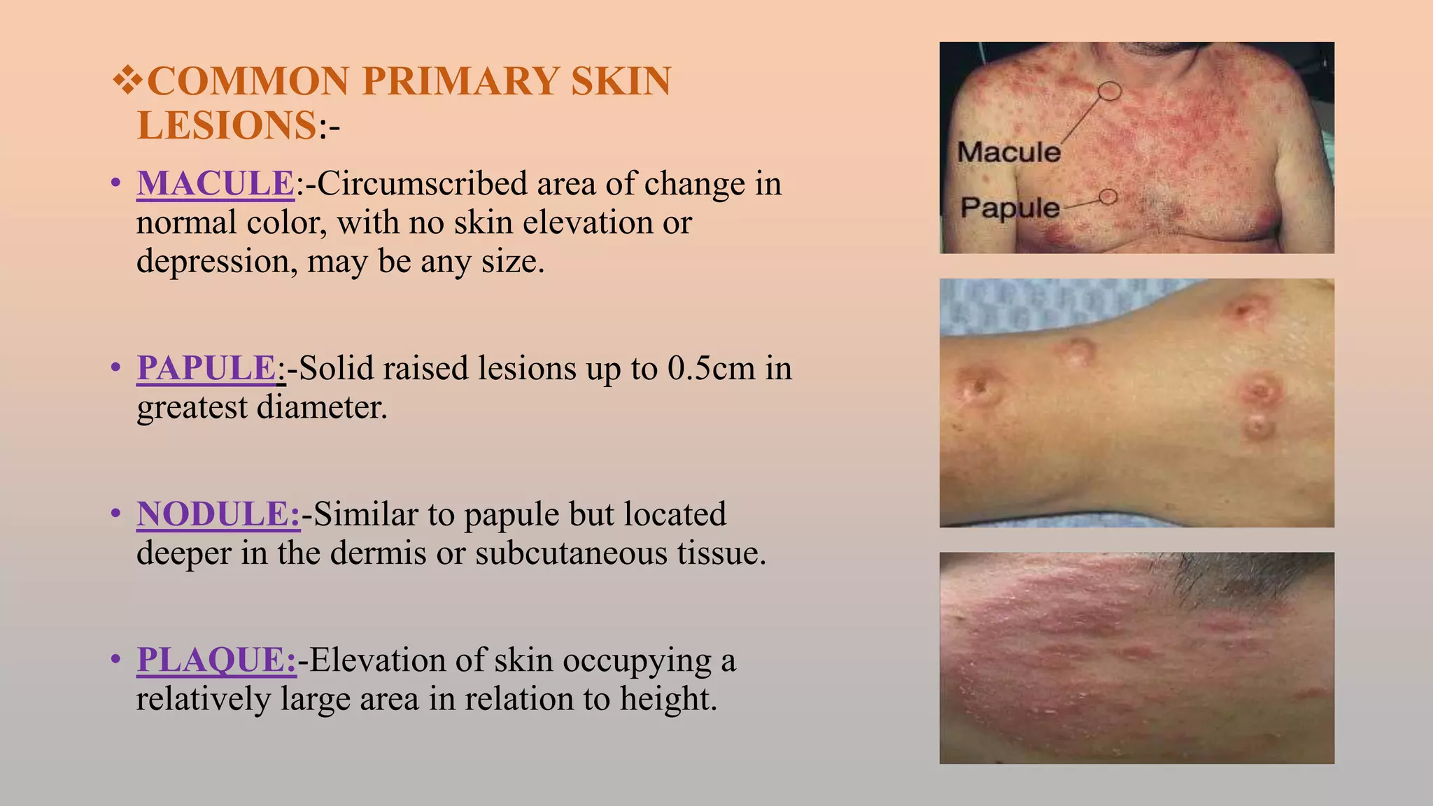 FEBRILE ILLNESS WITH SKIN RASHES.pptx