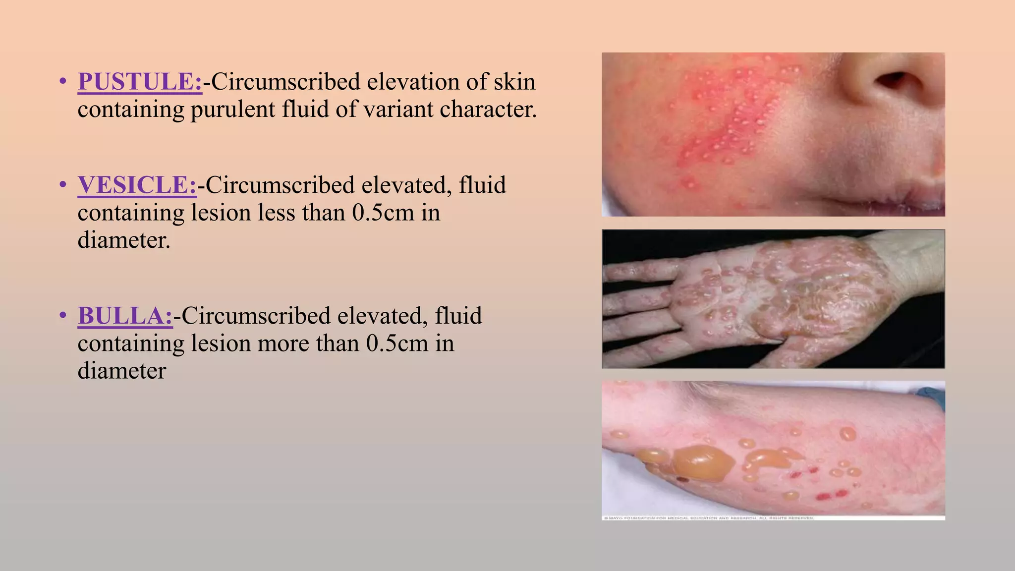 FEBRILE ILLNESS WITH SKIN RASHES.pptx