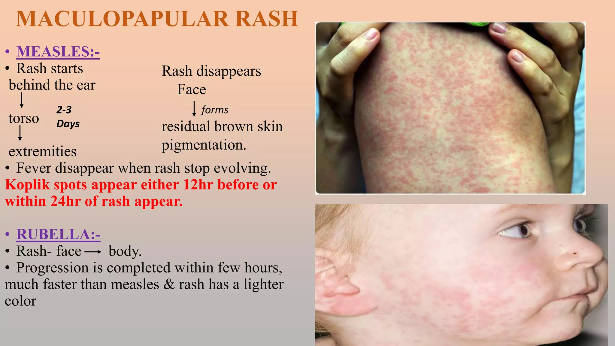 FEBRILE ILLNESS WITH SKIN RASHES.pptx