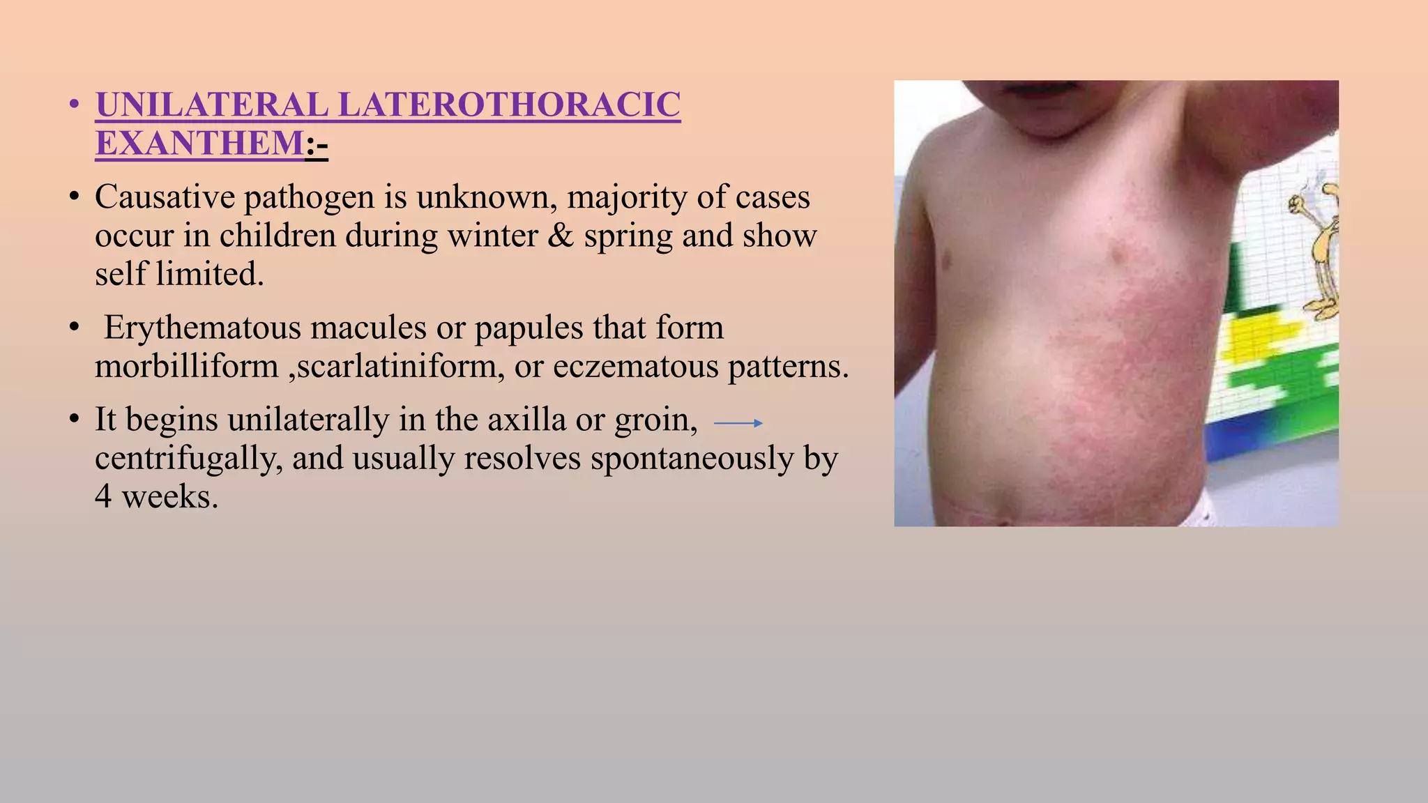 FEBRILE ILLNESS WITH SKIN RASHES.pptx