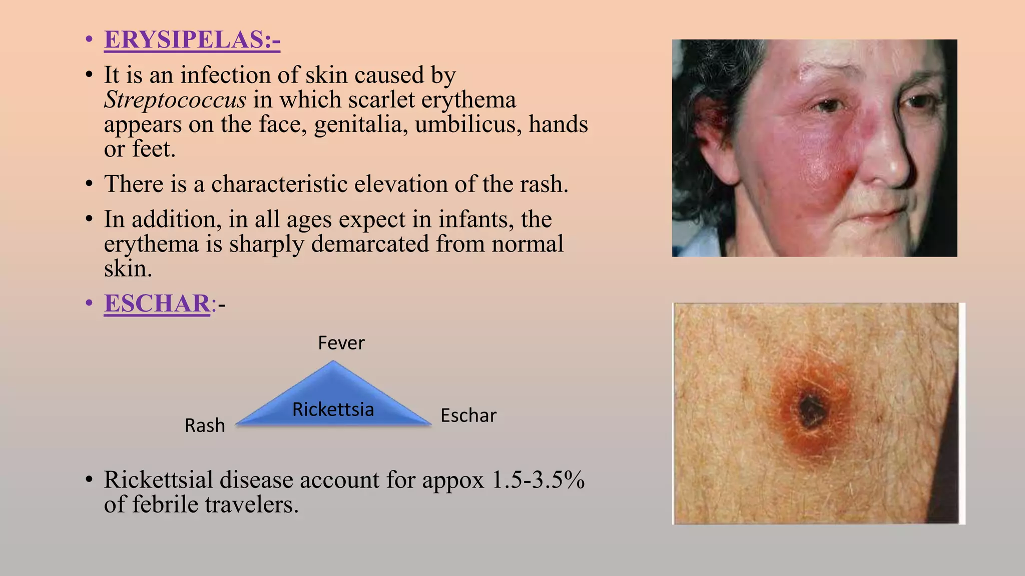FEBRILE ILLNESS WITH SKIN RASHES.pptx