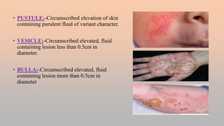 FEBRILE ILLNESS WITH SKIN RASHES.pptx
