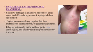 FEBRILE ILLNESS WITH SKIN RASHES.pptx
