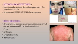 [Pdf] Febrile Illness With Skin Rashes – PIPIH