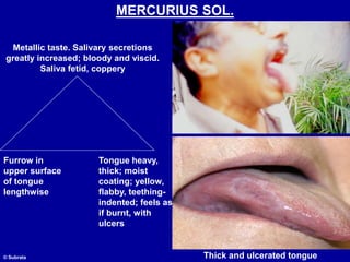 FEBRUARY 2015-TONGUE.ppt