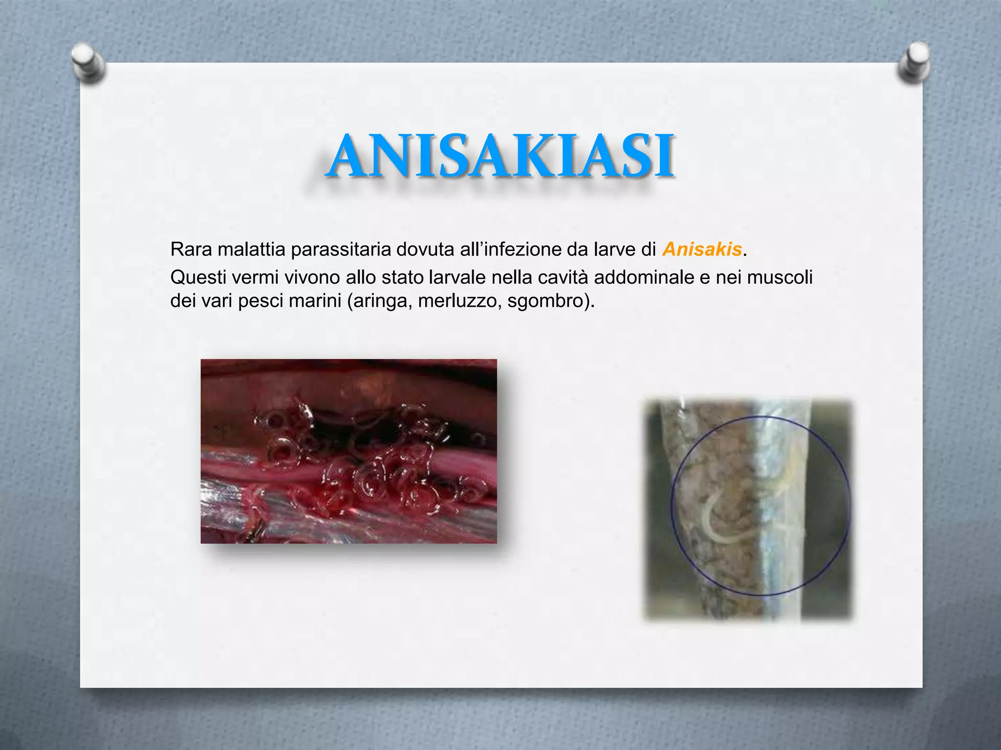 Parassitosi alimentari | PPTX
