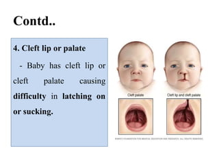 Feeding Difficulty.Samikshya.pptx