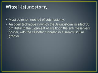 Feeding jejunostomy | PPTX