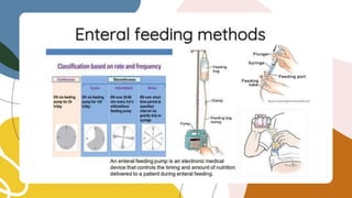 Special nutritional support (feeding methods).pptx