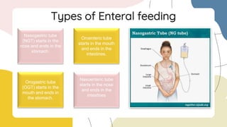 Special nutritional support (feeding methods).pptx