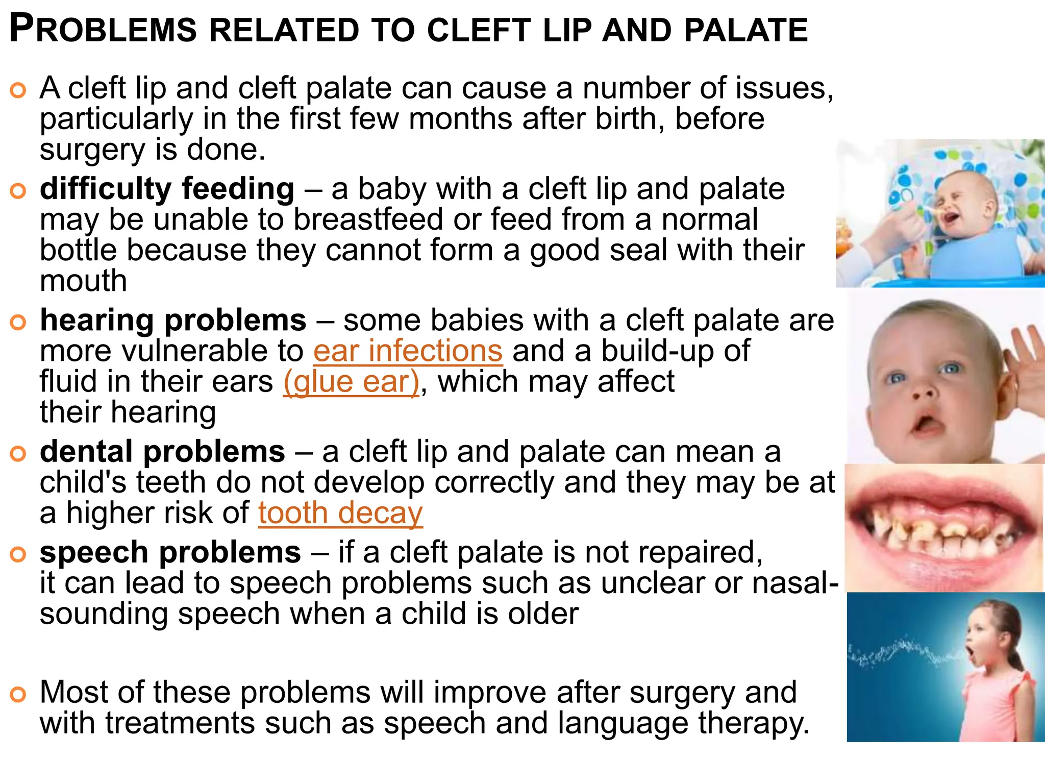 Feeding plate for a newborn with Cleft Palate.pptx