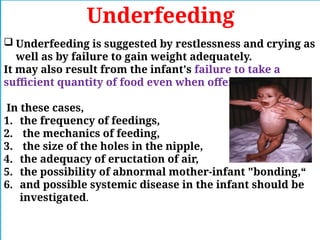 FEEDING PROBLEMS in children and infants.pptx