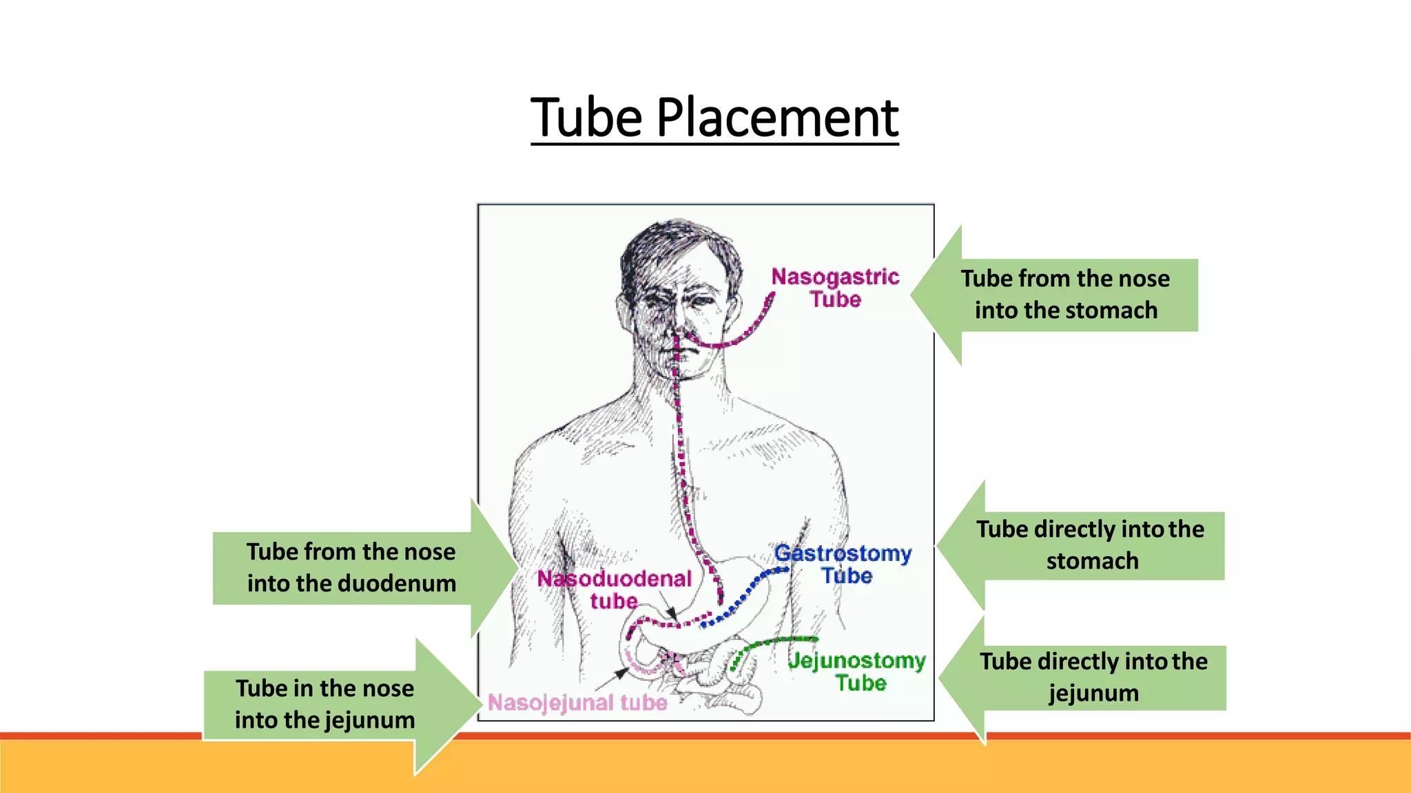 Feeding Techniques.pptx