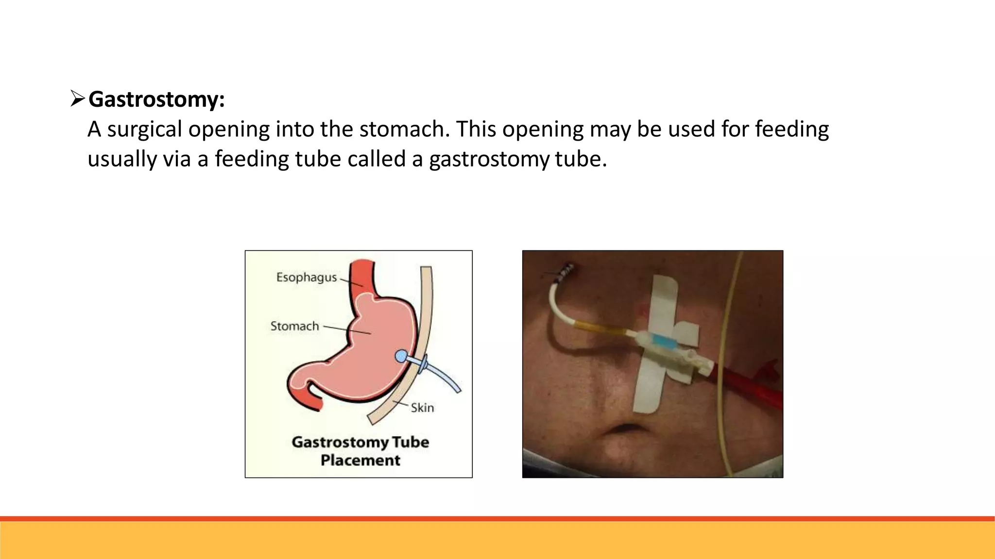 Feeding Techniques.pptx