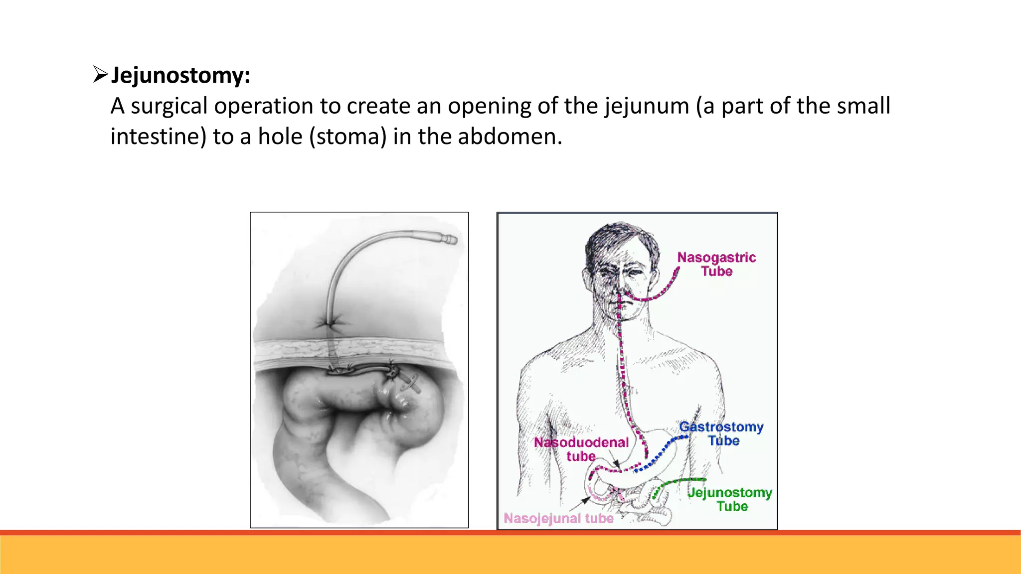 Feeding Techniques.pptx