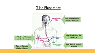 Feeding Techniques.pptx