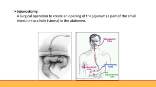 Feeding Techniques.pptx