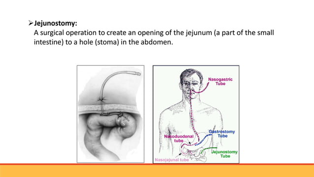 Feeding Techniques.pptx
